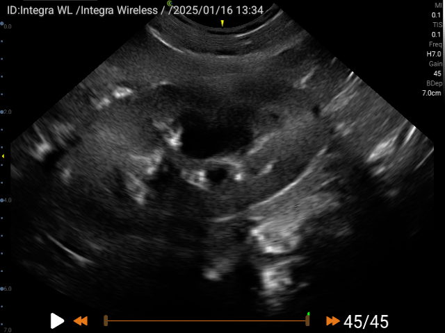 Integra Wireless | Core Imaging